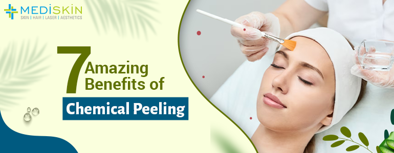 7 Amazing Benefits of Chemical Peeling | You Should Know